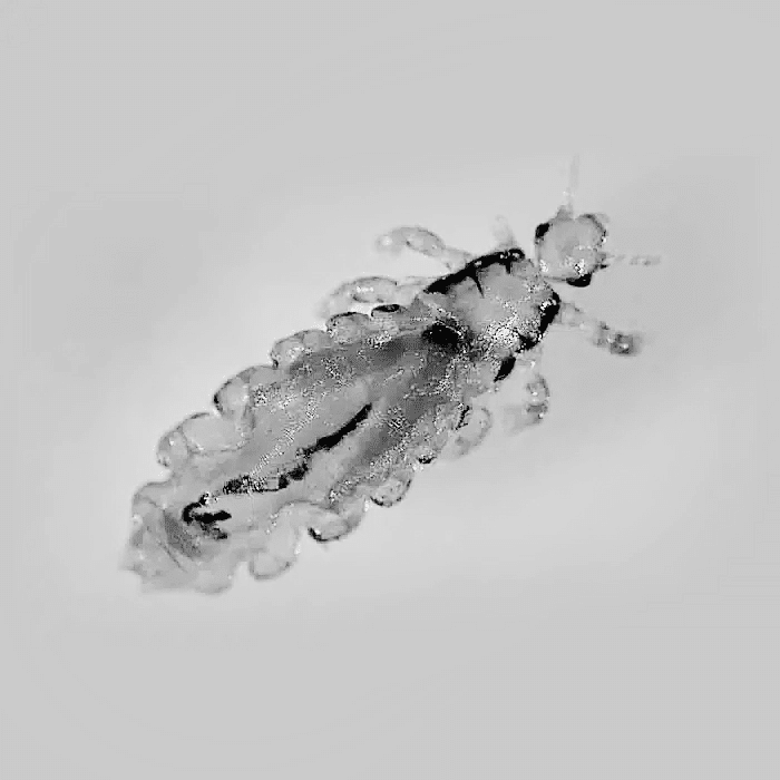 About Head Lice And How To Remove Head Lice And Eggs